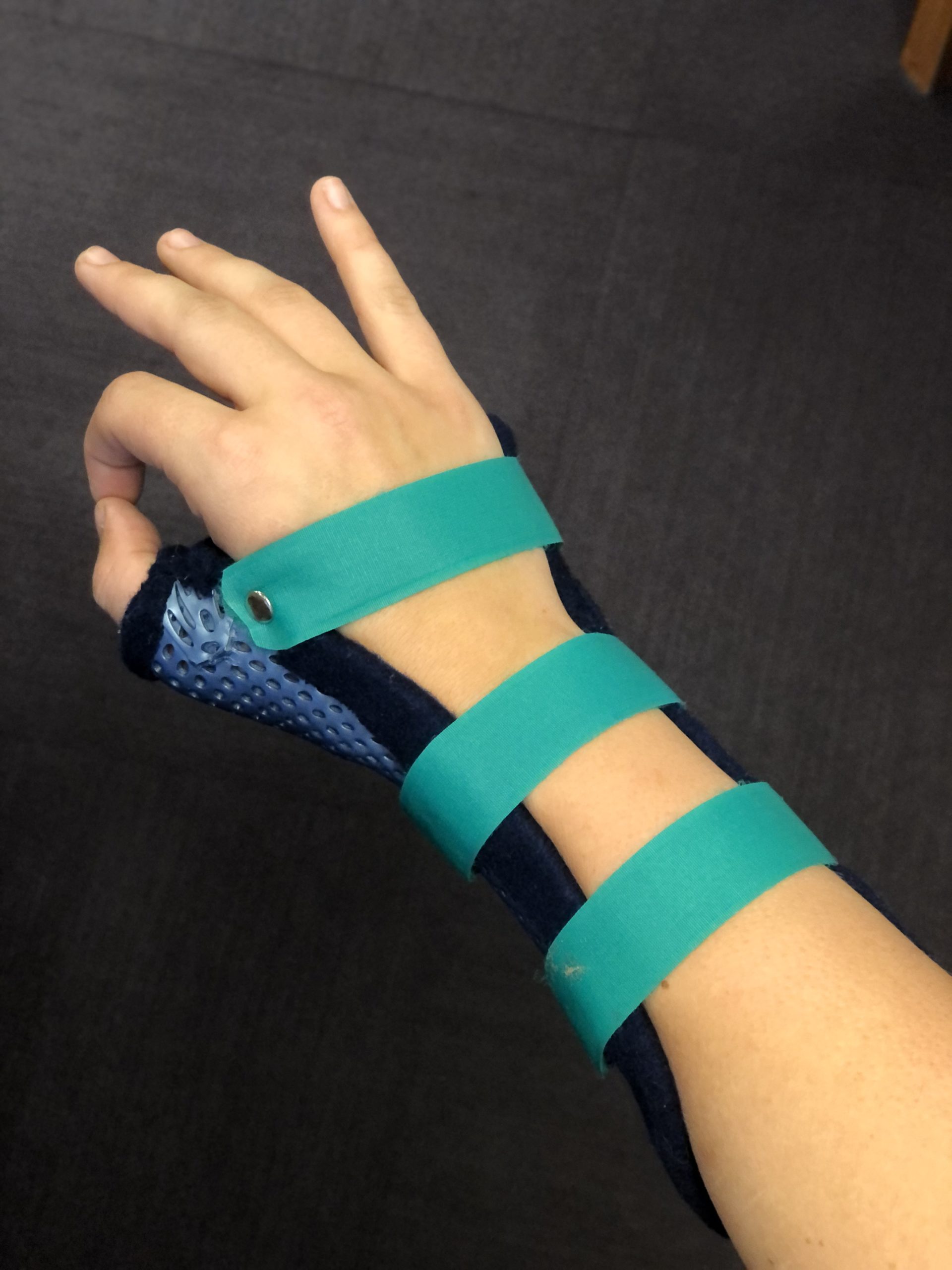 What Causes Thumb Pain & How to Reduce It - Alaska Hand Rehabilitation